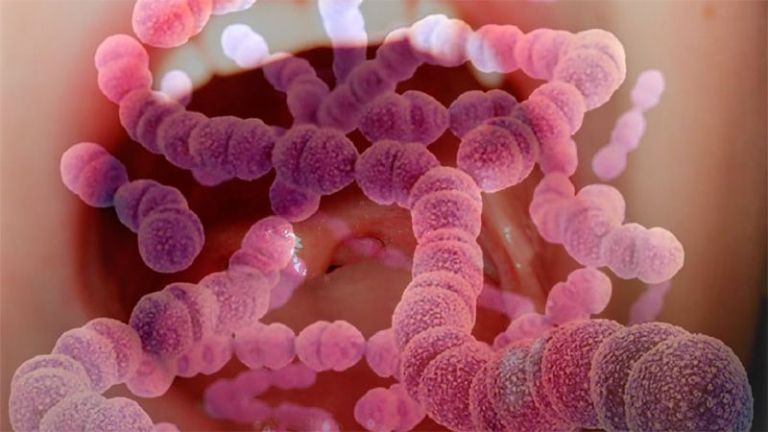 “El sistema de salud de San Luis está alerta y preparado ante la angina ...